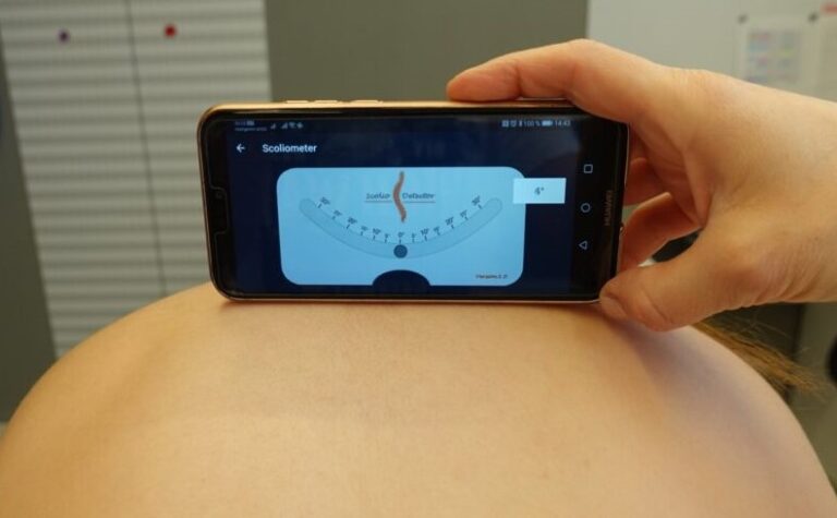 Vadné držení těla vs. skolióza. V čem je rozdíl? | Fyzioterapie online